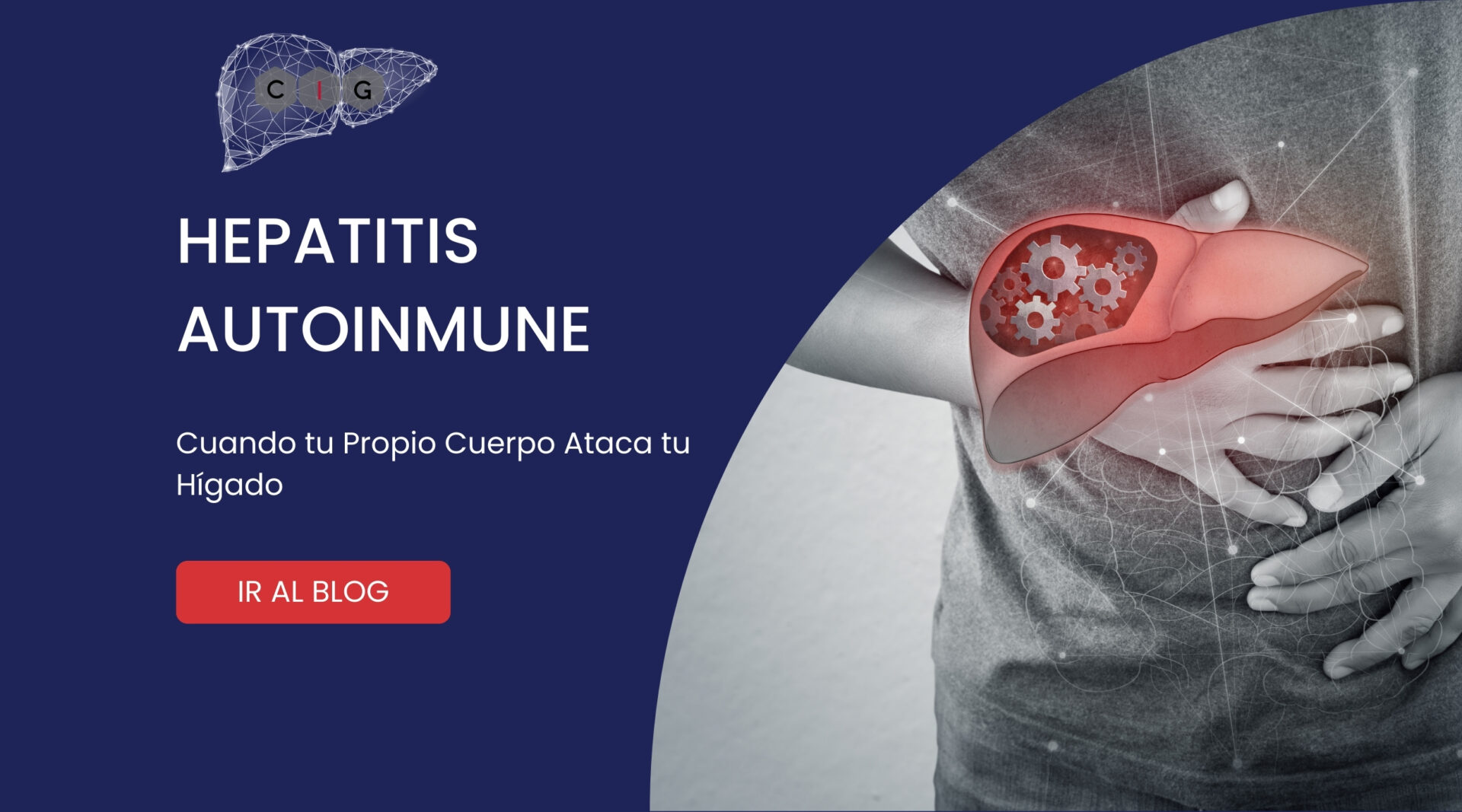 Hepatitis Autoinmune: Cuando tu Propio Cuerpo Ataca tu Hígado - CIG