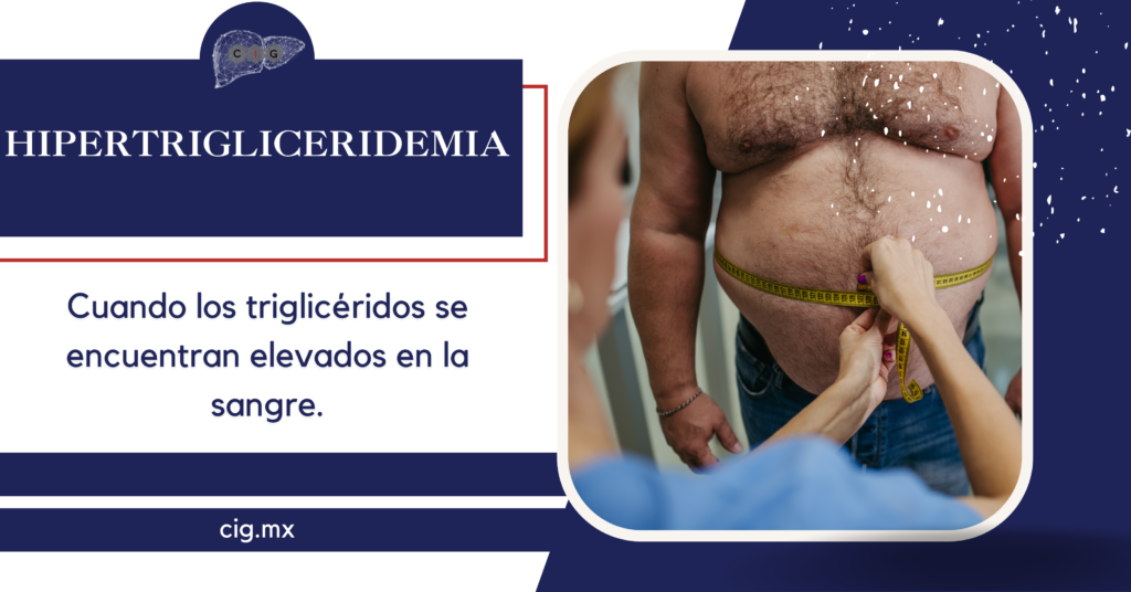 Hipertrigliceridemia: Triglicéridos elevados en sangre - CIG